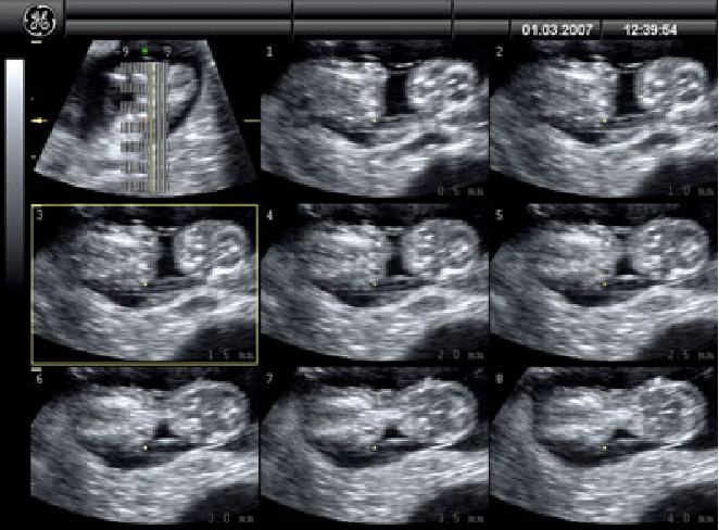 Pregnant Dog Ultrasound