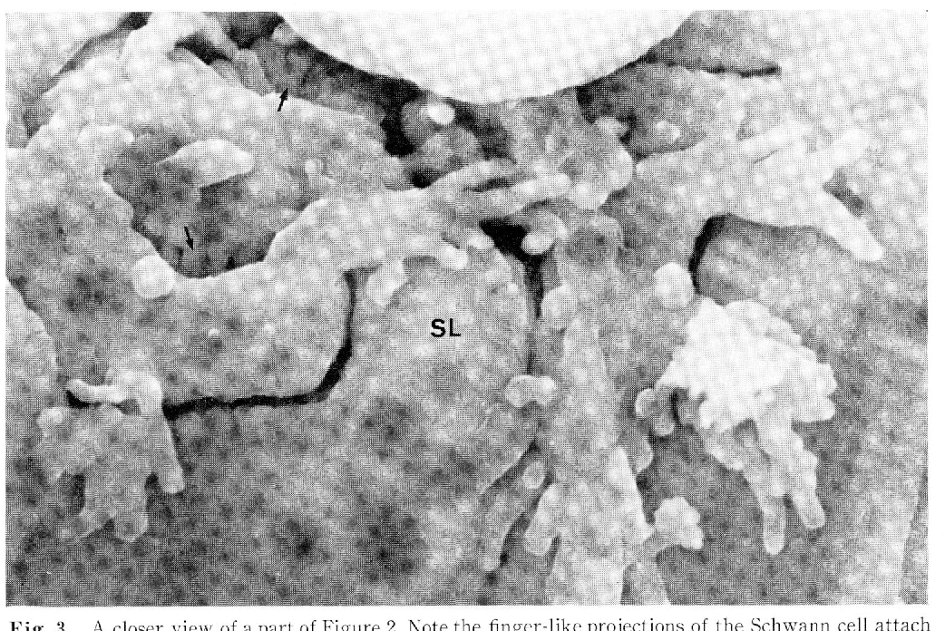 Figure 3 From Scanning Electron Microscope Studies On The Schwann Cells