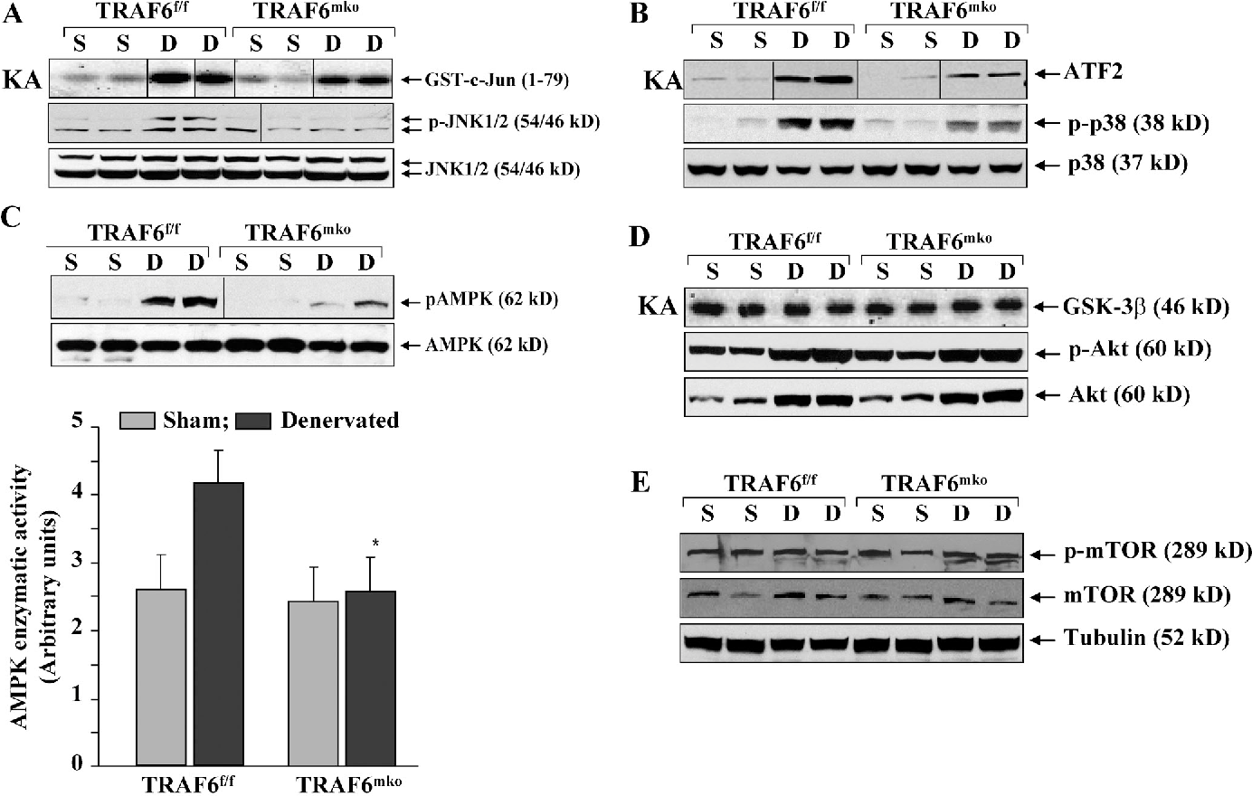 Figure 1 From Targeted Ablation Of Traf6 Inhibits Skeletal Muscle