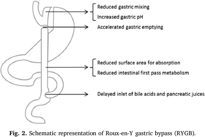 Pdf Impact Of Gastrointestinal Physiology On Drug Absorption In