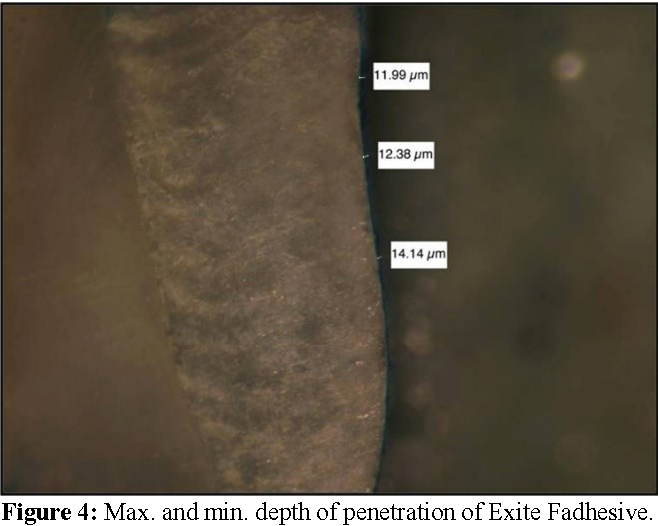 Figure 1 From Penetration Depth And Enamel Microhardness Of Resin