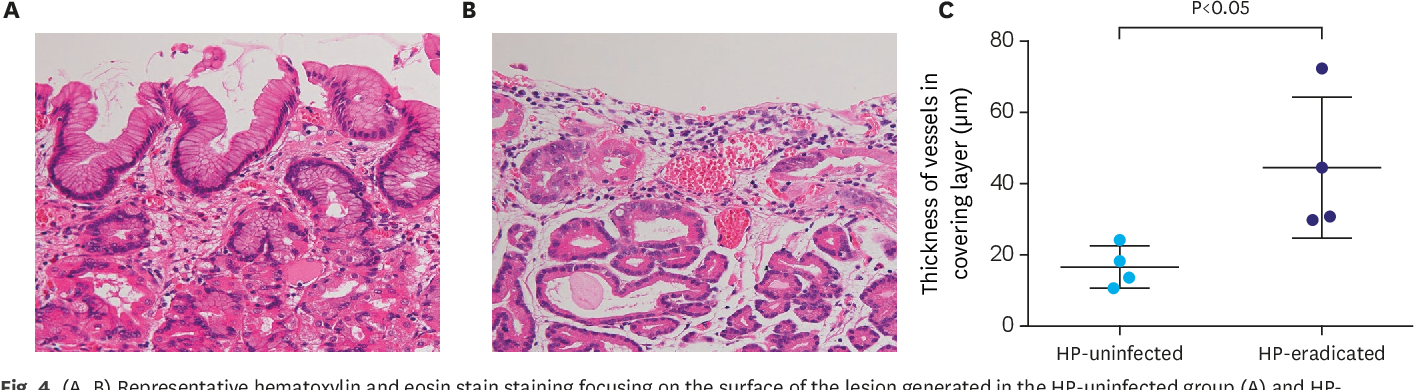 Figure 1 From Influence Of Helicobacter Pylori Infection On Endoscopic