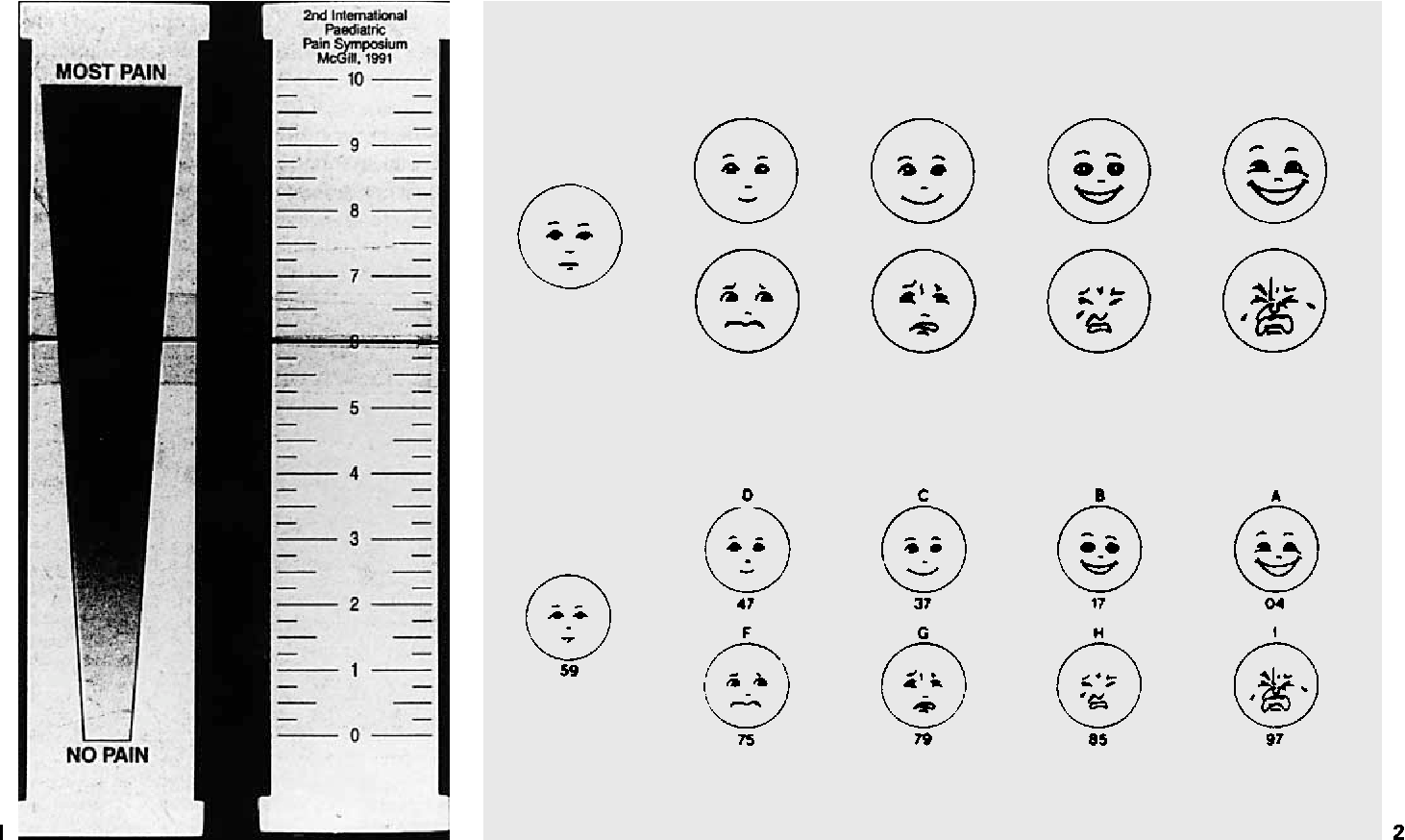 Visual Analog Pain Scale Printable