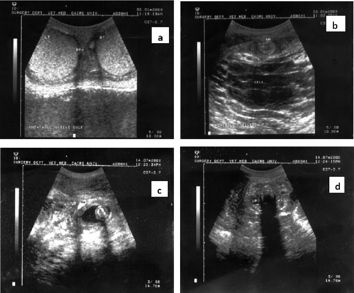 Scrotal Edema Ultrasound