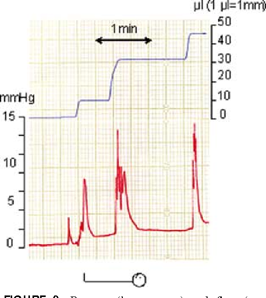 Contractility Patterns Of Human Leg Lymphatics In Various Stages Of