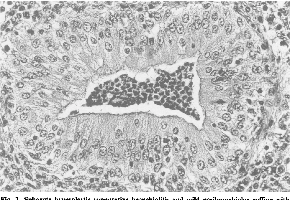 Mycoplasma Ovipneumoniae Semantic Scholar