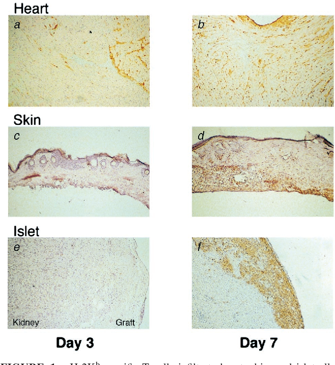 Figure 1 From Islet Allografts To T Cell Mediated Rejection