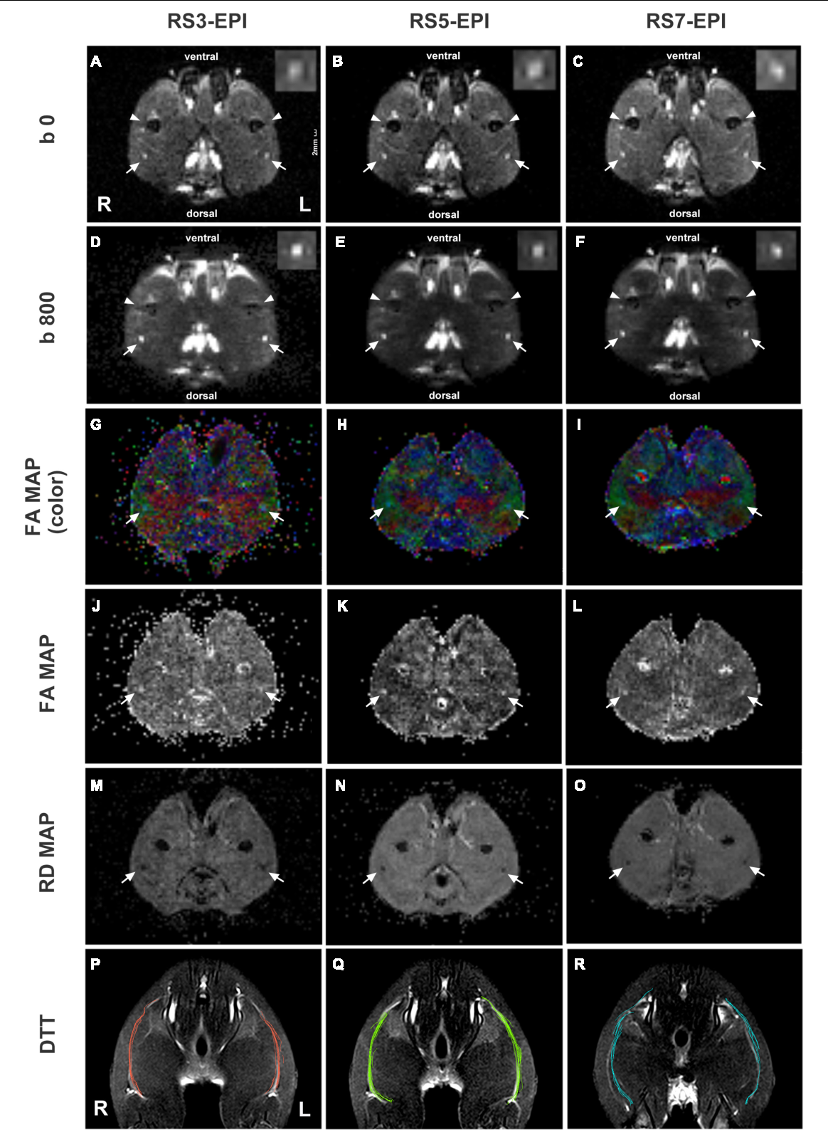 Figure 1 From Assessment Of Rat Sciatic Nerve Using Diffusion Tensor