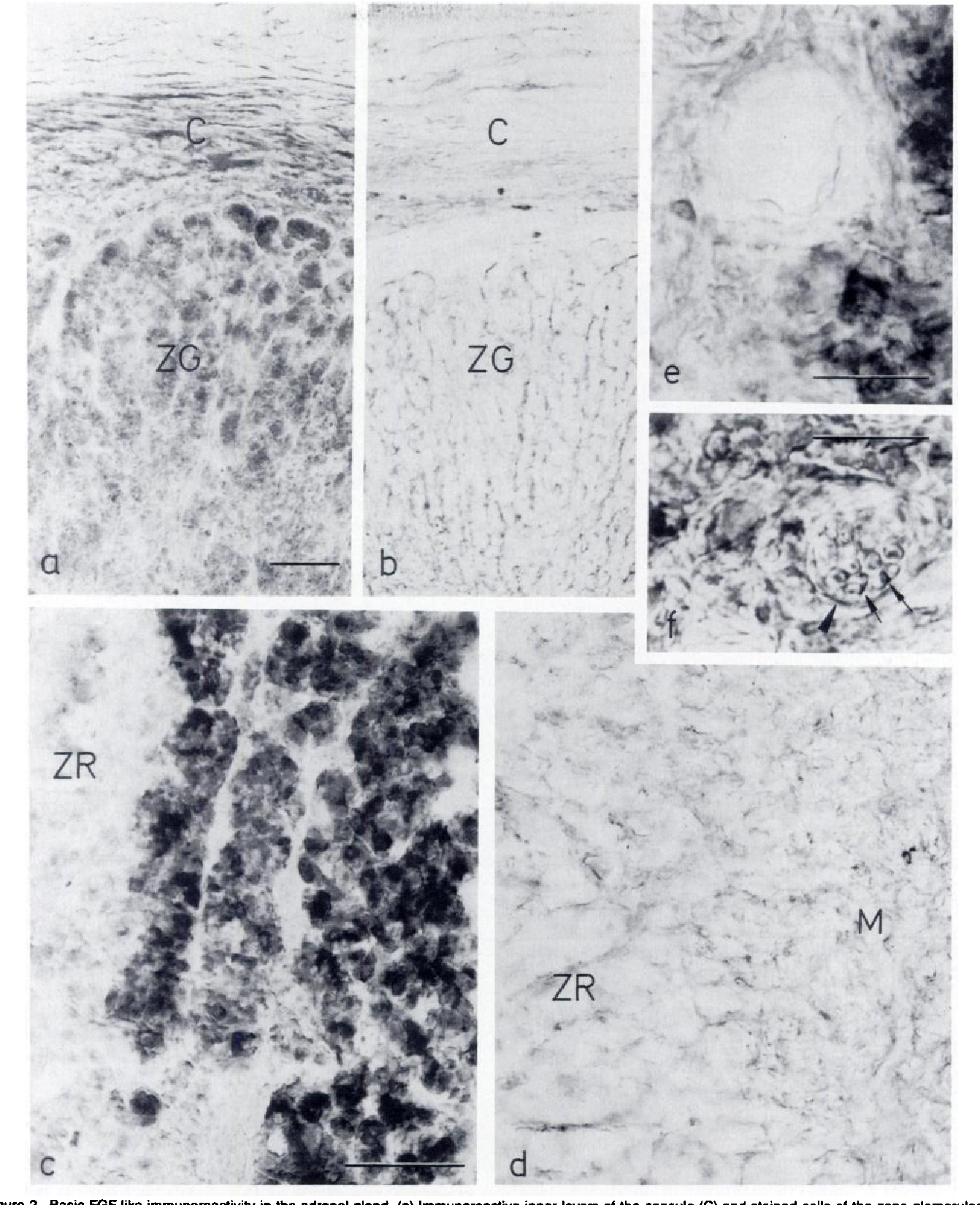 Figure 1 From Immunocytochemical Localization Of Basic Fibroblast