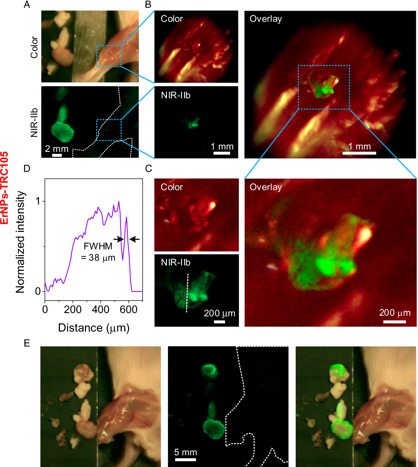 Figure 4 From High Precision Tumor Resection Down To Few Cell Level