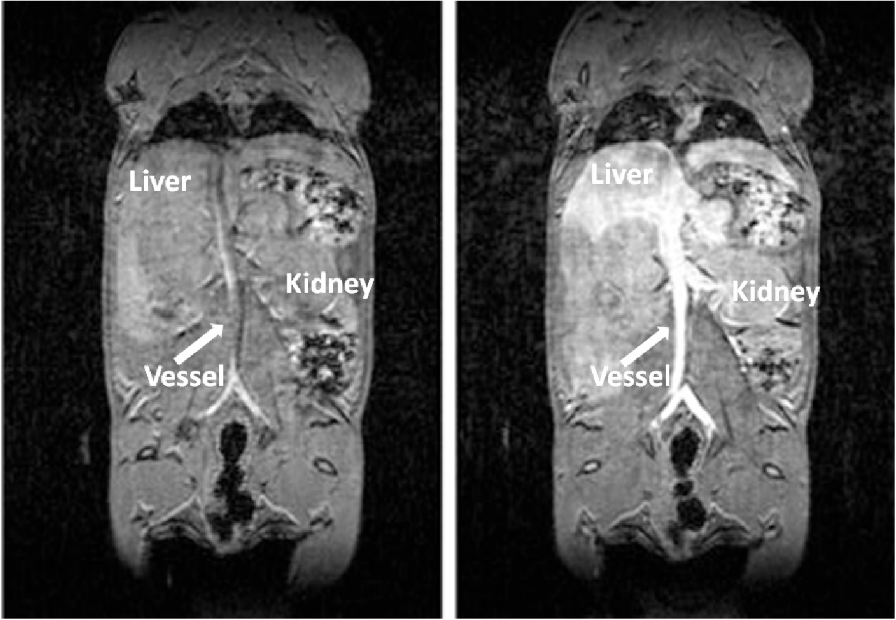 Design Of Novel Protein Based Mri Contrast Agernets With High