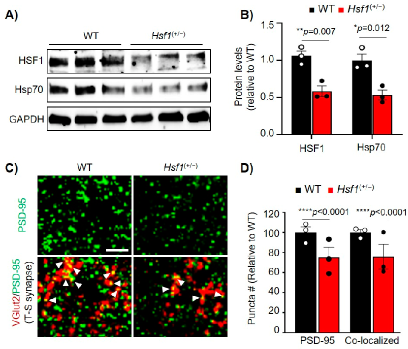 Pdf Heat Shock Factor 1 Directly Regulates Postsynaptic Scaffolding