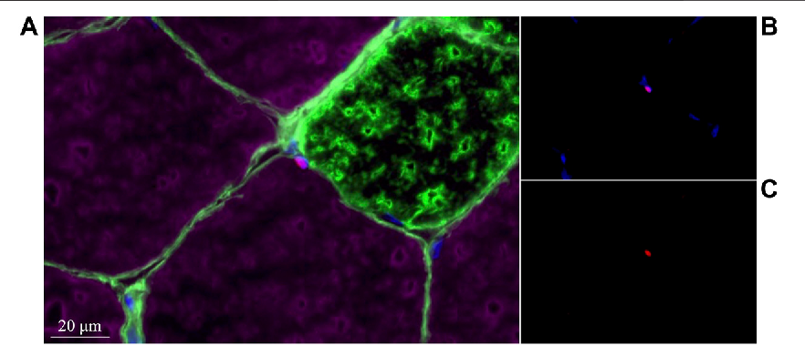 Sex Based Differences In The Myogenic Response And Inflammatory Gene