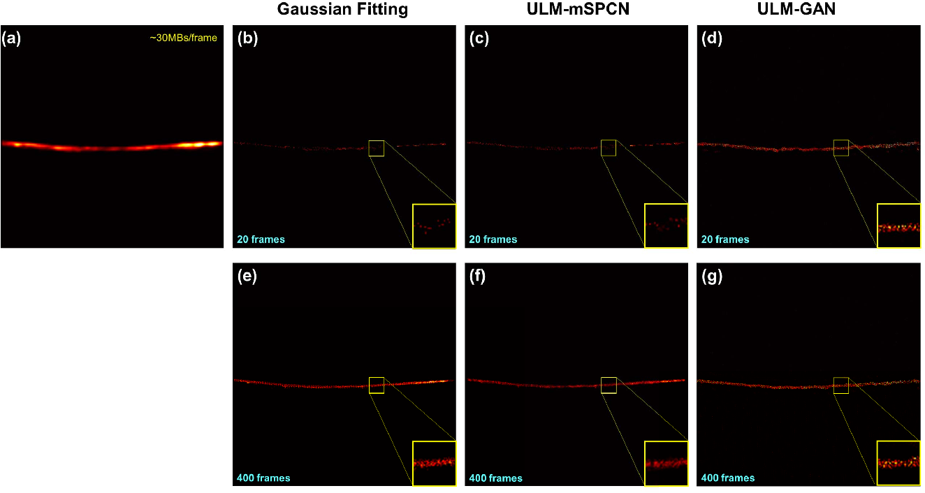 Figure 1 From Ultrafast Ultrasound Localization Microscopy By