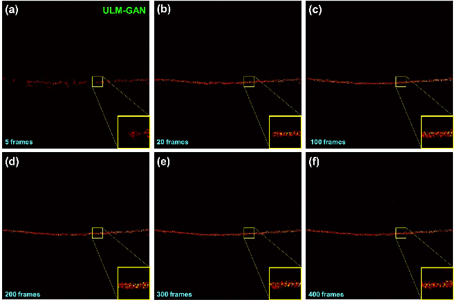 Figure 1 From Ultrafast Ultrasound Localization Microscopy By