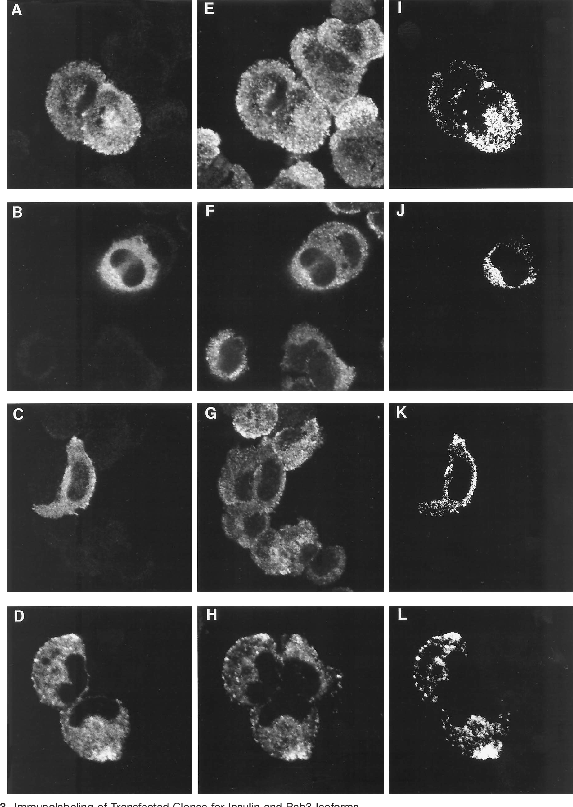 Figure 1 From Subcellular Distribution And Function Of Rab3a B C And