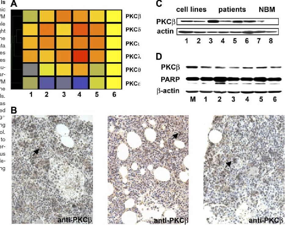 Figure 1 From Protein Kinase C Inhibitor Enzastaurin Induces In Vitro