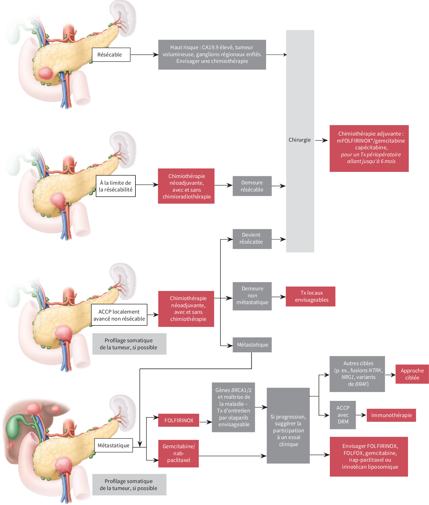 Figure 1 From Avancées Dans La Prise En Charge De Ladénocarcinome