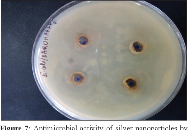 Green Synthesis Of Silver Nanoparticles Using Stem Extract Of Berberis