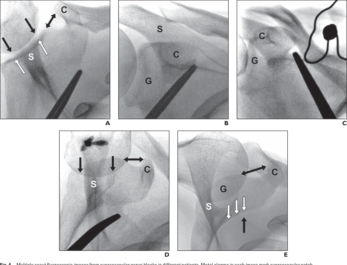 Optimization And Standardization Of Technique For Fluoroscopically