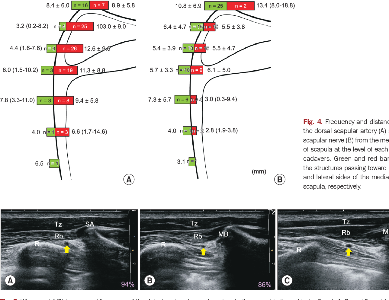 Figure 2 From New Insights Into Pathways Of The Dorsal Scapular Nerve