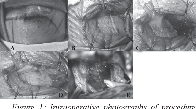 Figure 1 From Microsurgical Management Of Tuberculum Sellae Meningiomas