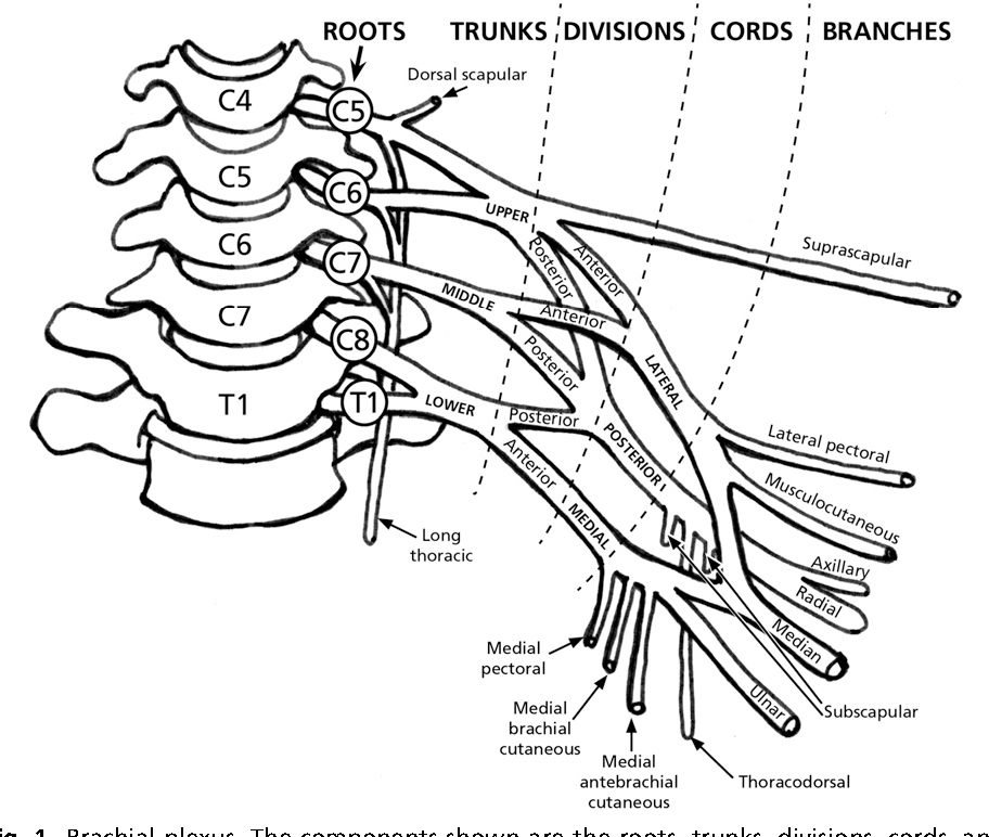 Figure 4 From Electrodiagnosis Of Brachial Plexopathies And Proximal
