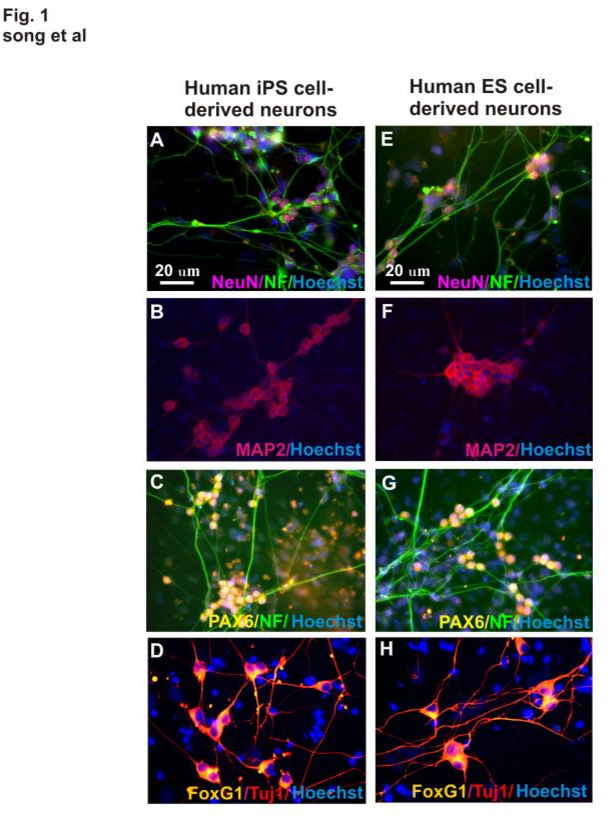 Figure 1 From Functional Maturation Of Pyramidal Like Neurons Derived