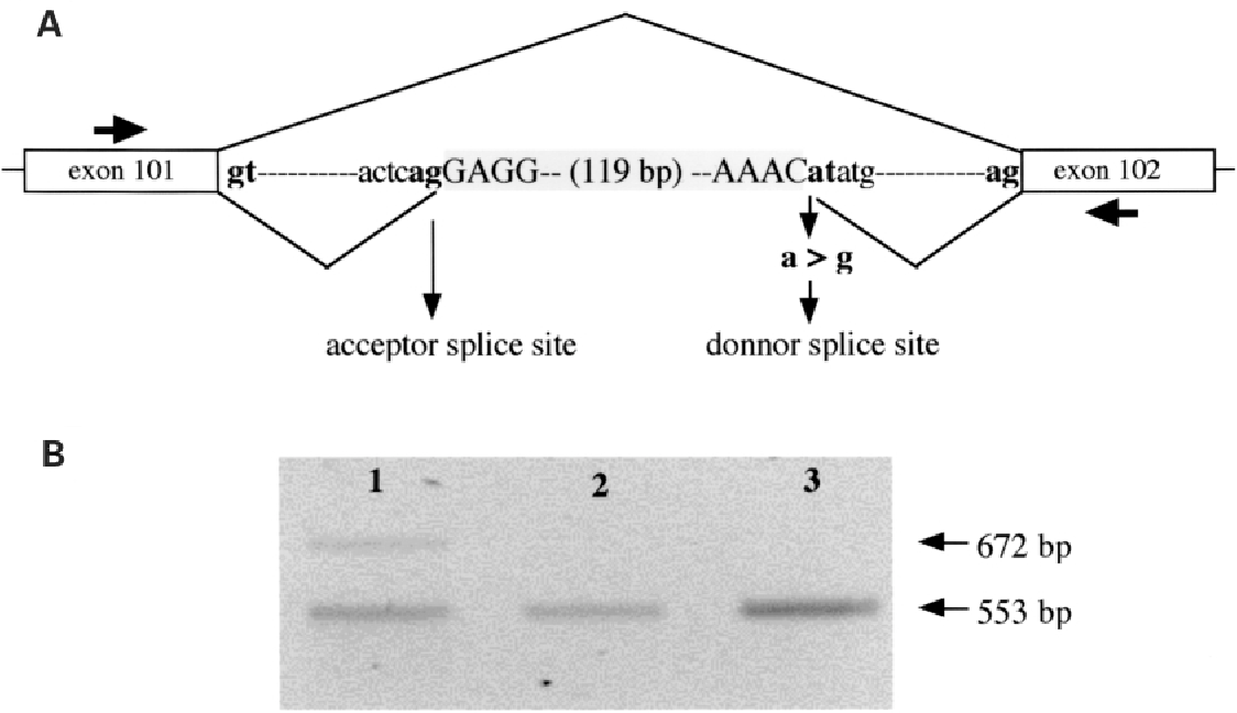 Figure 3 From A Homozygous Splicing Mutation Causing A Depletion Of