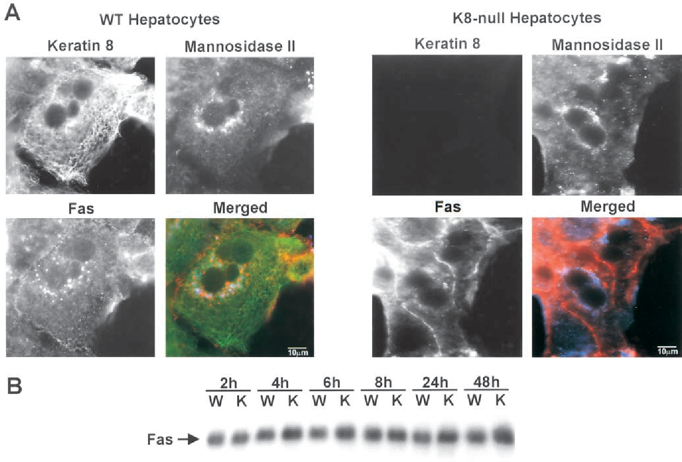 Figure 1 From Simple Epithelium Keratins 8 And 18 Provide Resistance To