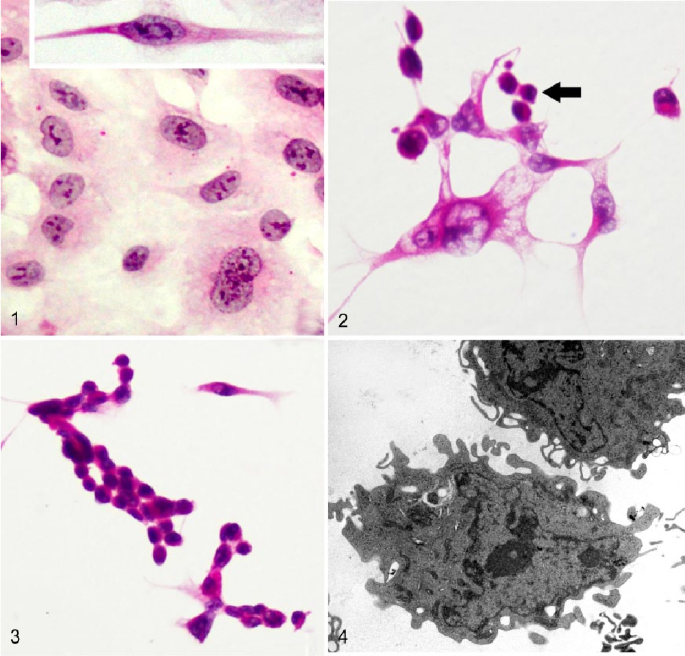 Figure 5 From Clostridium Perfringens Type D Epsilon Toxin Produces A