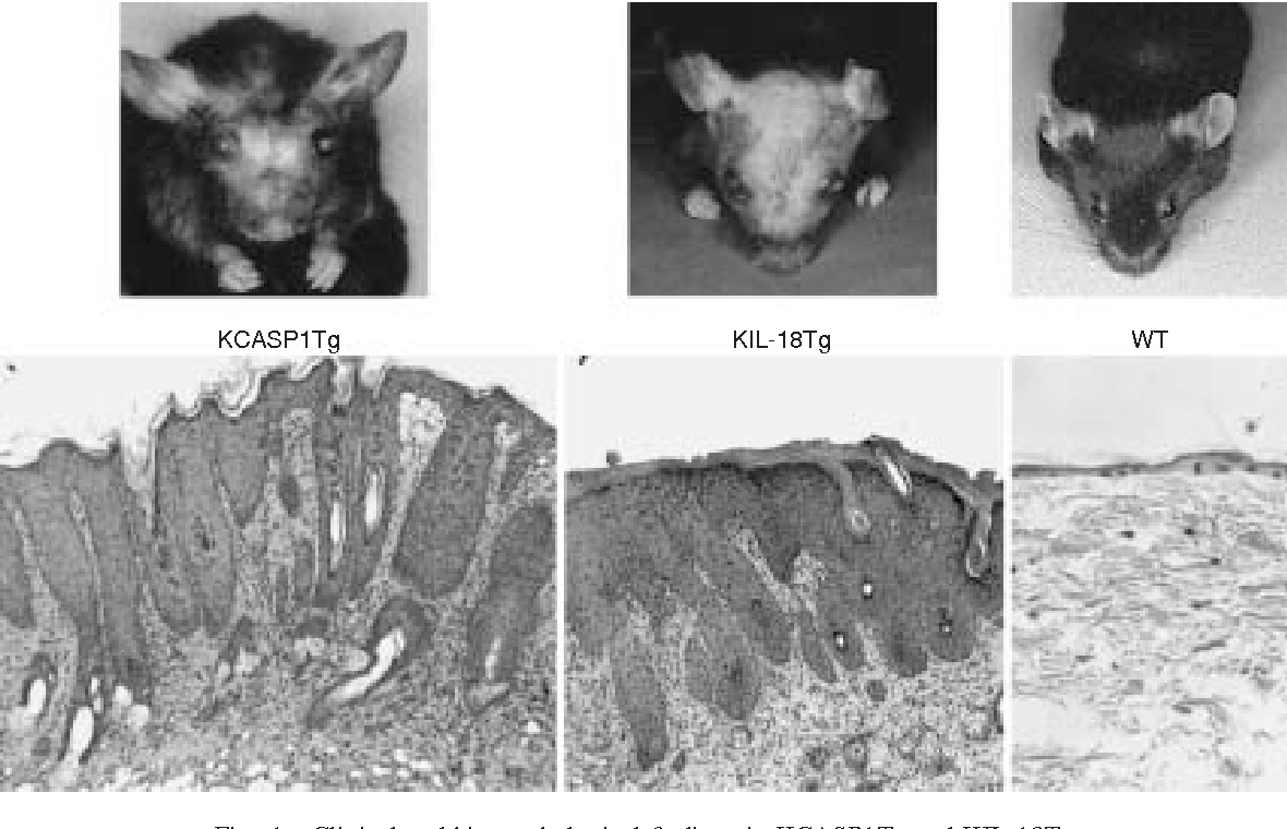 Figure 1 From Animal Models Of Atopic Dermatitis Semantic Scholar