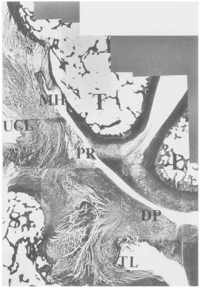 Figure 2 From Functional Anatomy Of The Triangular Fibrocartilage