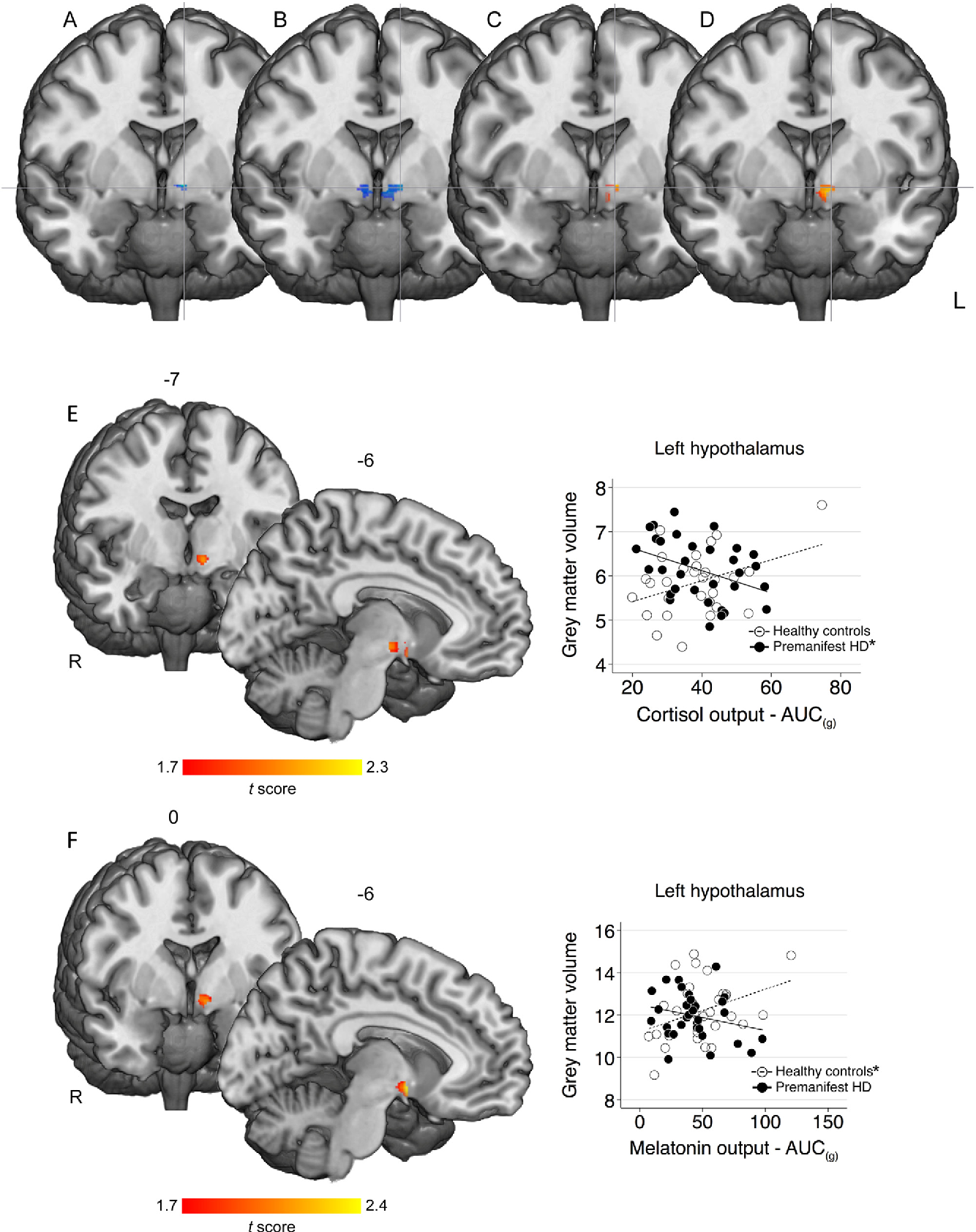 Figure 1 From Neurobiology Of Sleep And Circadian Rhythms Investigating