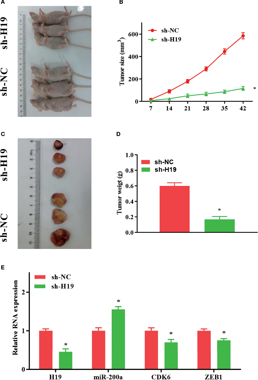 Figure 1 From Long Non−coding Rna H19 Regulates Glioma Cell Growth And