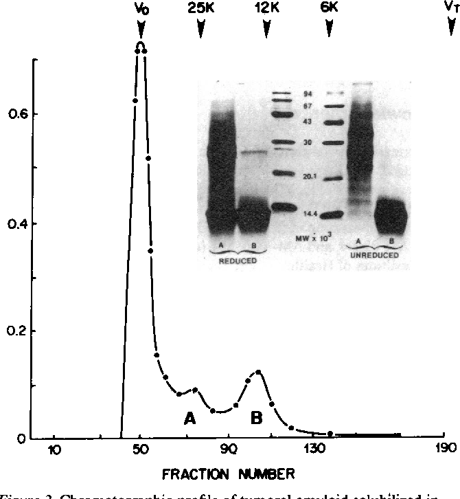 Pdf Beta 2 Microglobulin Is An Amyloidogenic Protein In Man