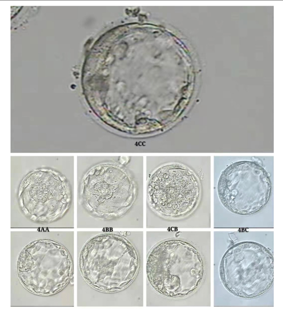 Figure 1 From A Non Invasive Chromosome Screening Strategy For