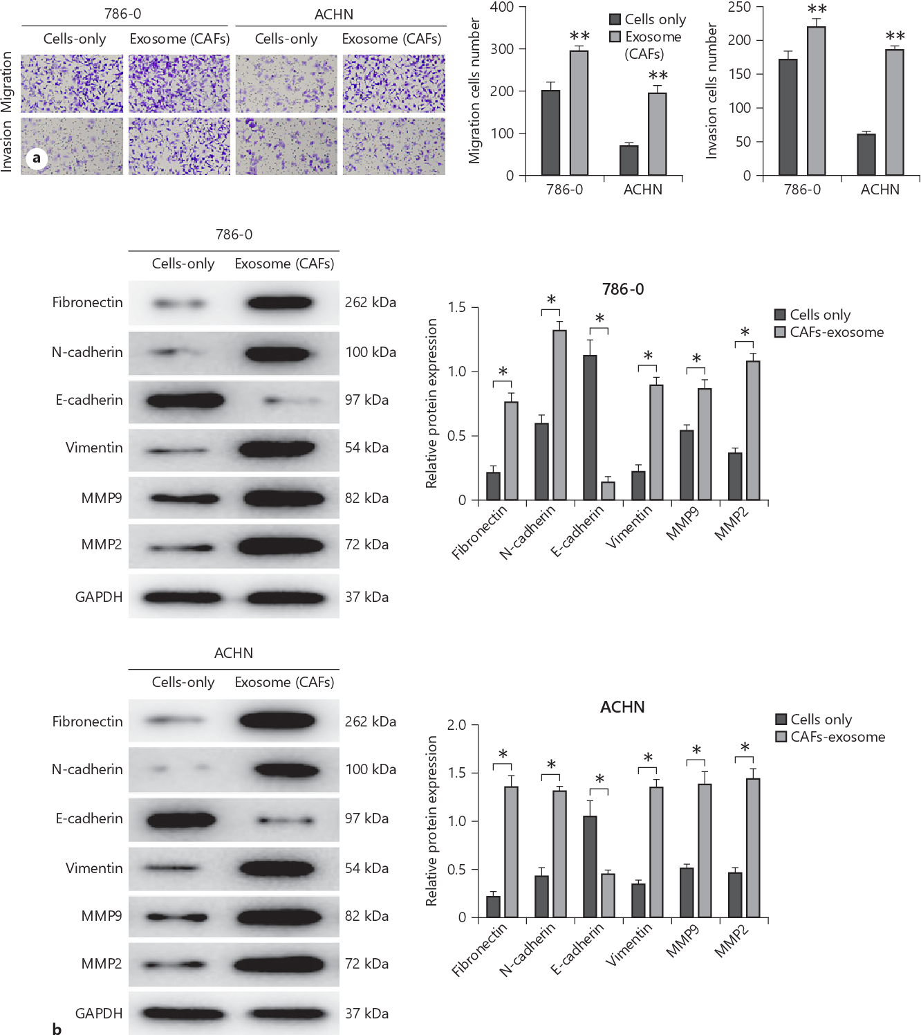 Figure 3 From Exosomes Derived From Cancer Associated Fibroblasts