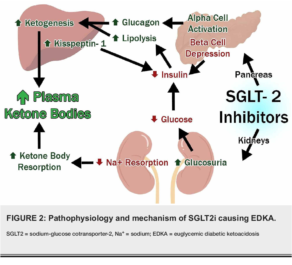 Figure 1 From Euglycemic Diabetic Ketoacidosis And Sodium Glucose