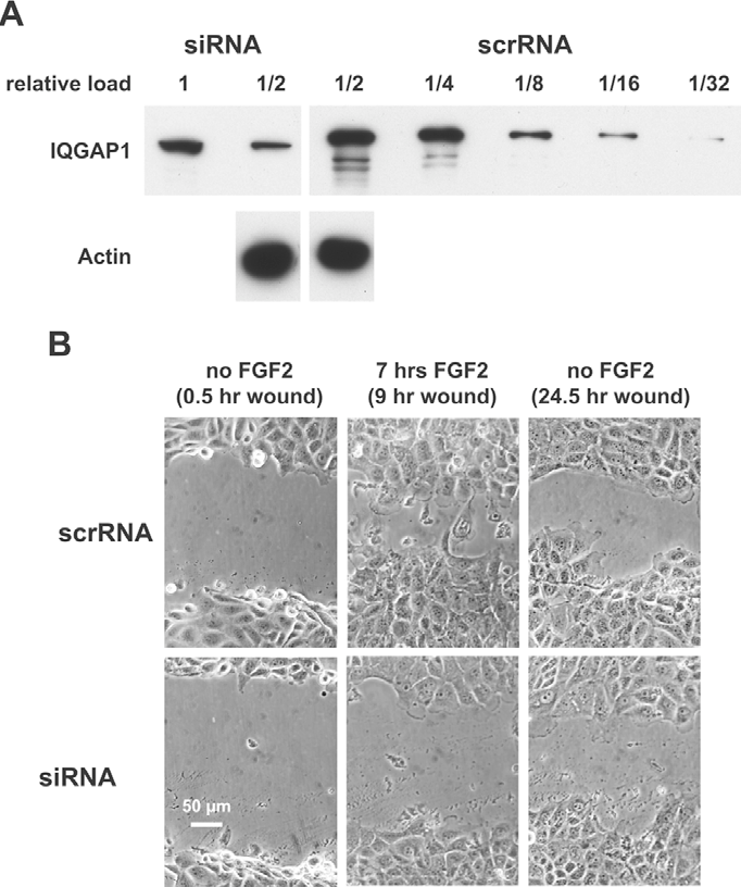 Figure 1 From Iqgap1 Regulates Cell Motility By Linking Growth Factor