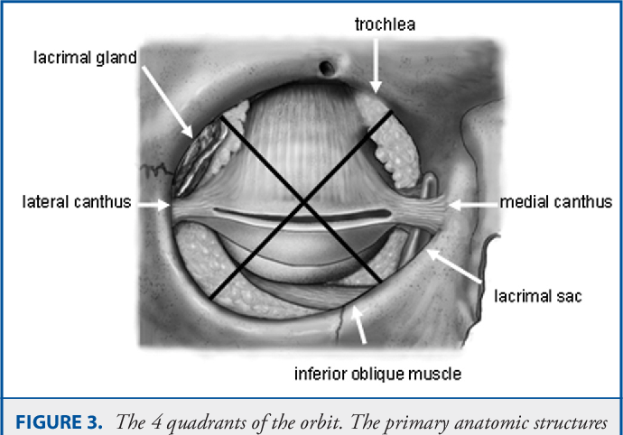 Transorbital Neuroendoscopic Surgery Semantic Scholar