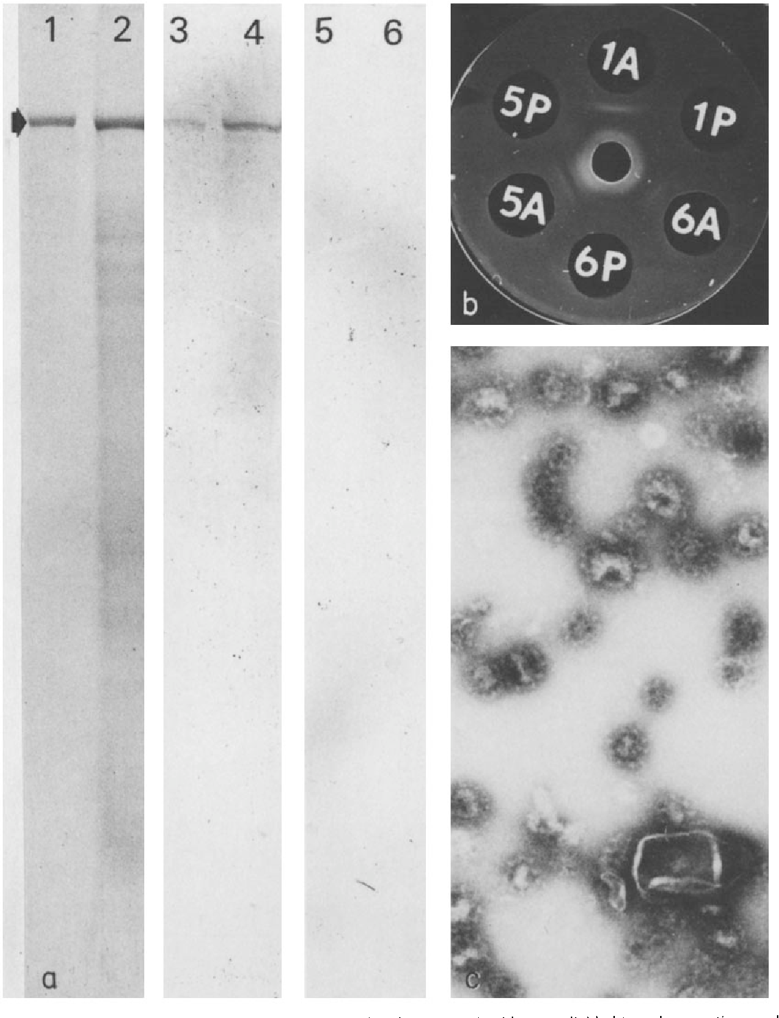 Figure 1 From Immunocytochemical Localization Of Coated Vesicle Protein