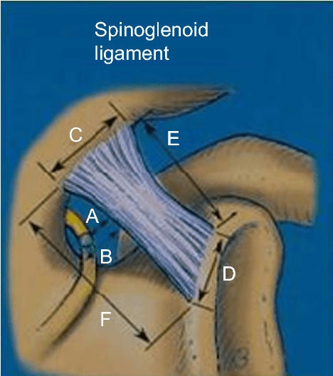 Figure 5 From Posterior Shoulder Pain And Arthroscopic Decompression Of