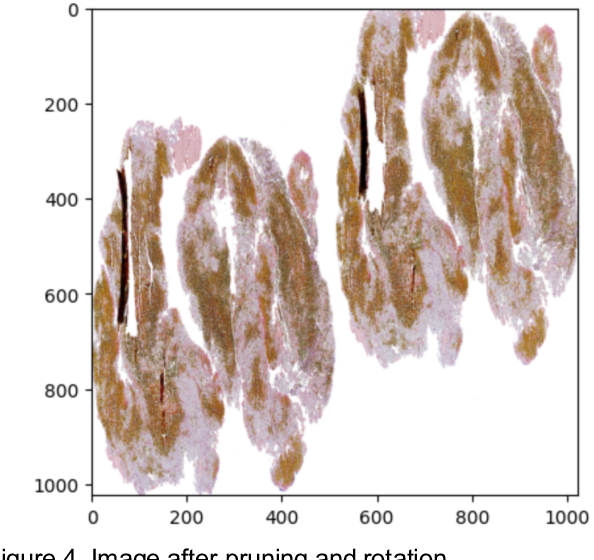 Figure 1 From Image Classification Of Stroke Blood Clot Origin Using