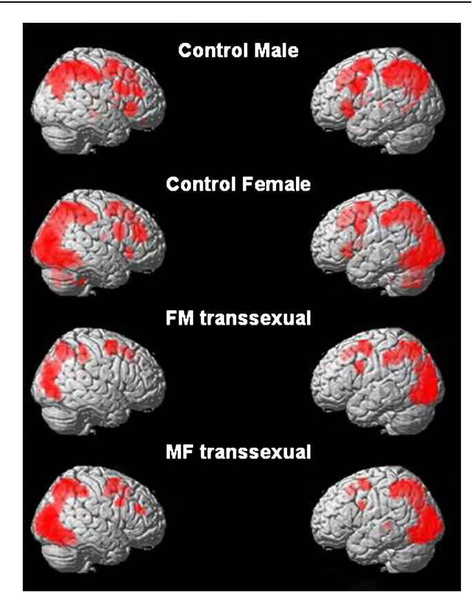 Figure 1 From Cortical Activation During Mental Rotation In Male To