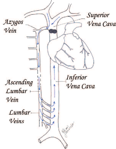 Superior Vena Cava Syndrome Collateral Circulation