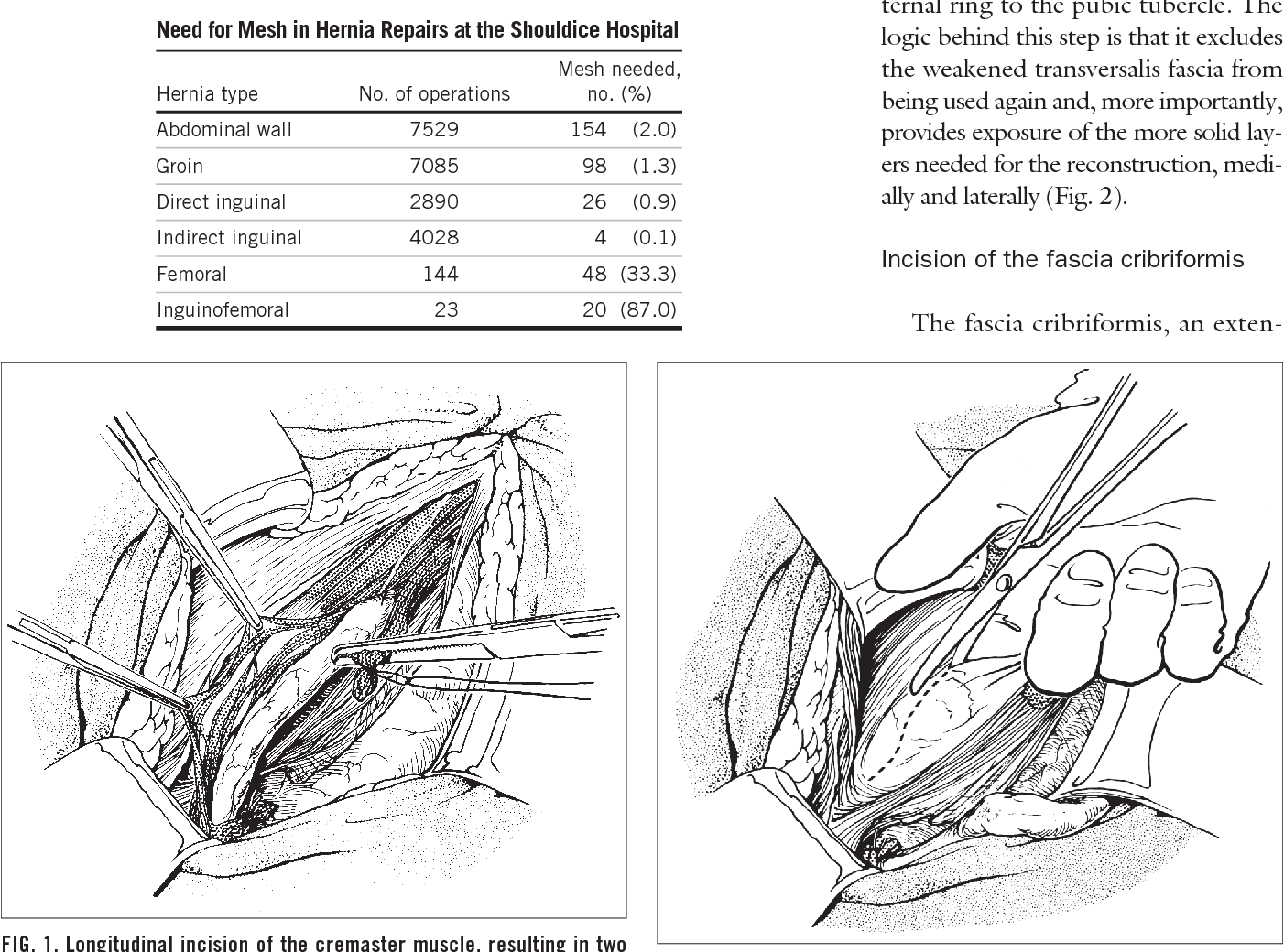 Inguinal Hernia Surgical Anatomy