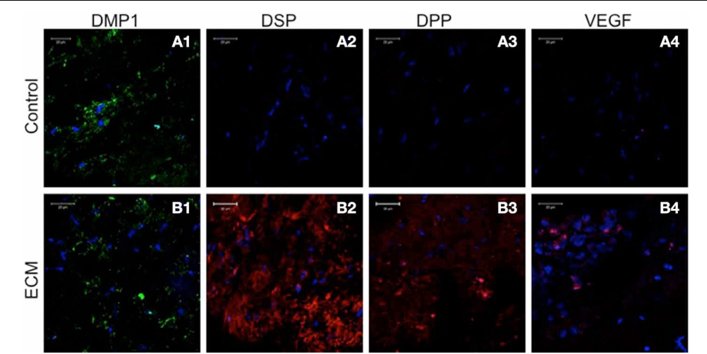 Table 1 From Extracellular Matrix Of Dental Pulp Stem Cells