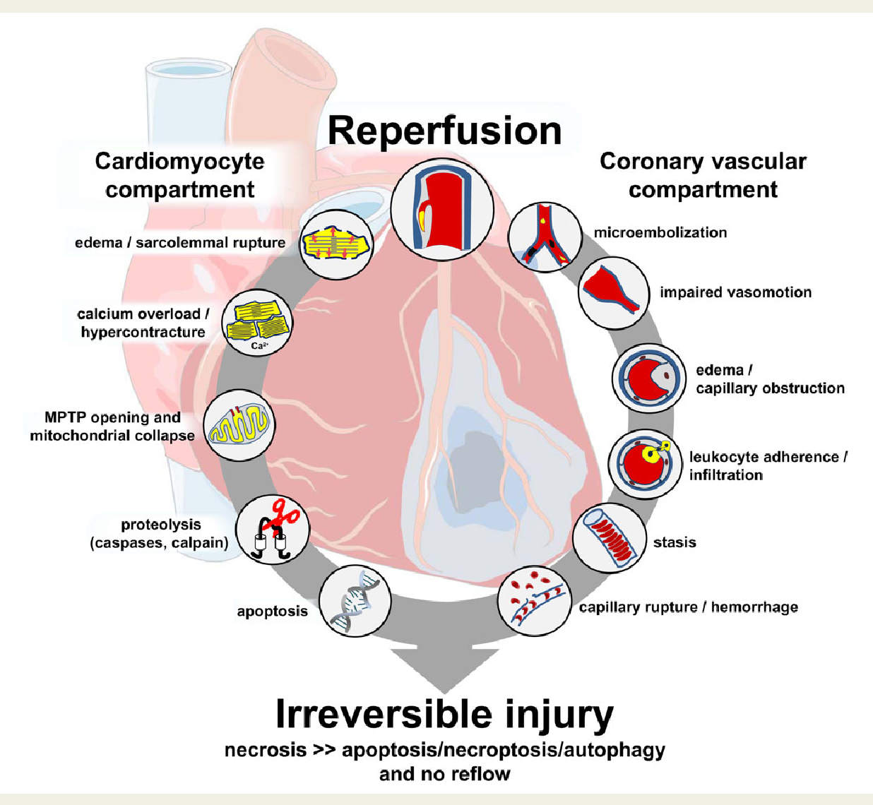 Pdf Pathophysiology Of Myocardial Infarction And Acute Management Hot