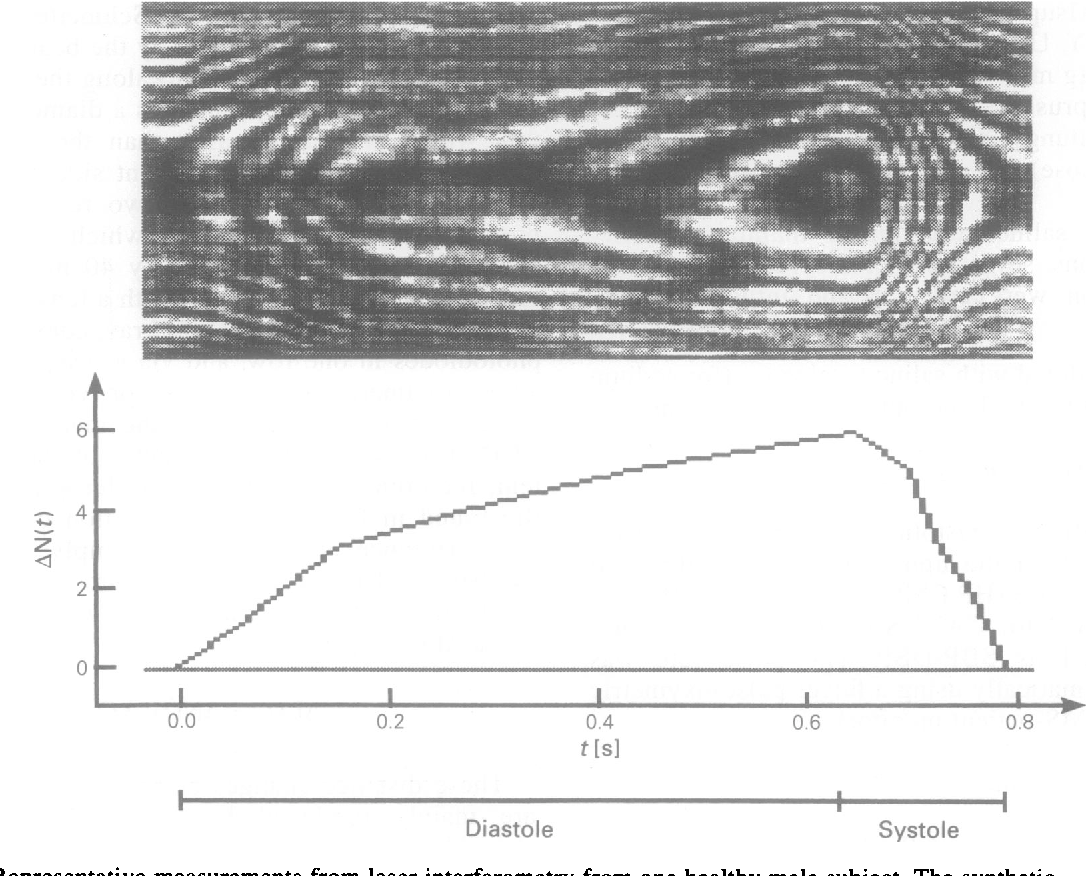 Figure 1 From Comparison Of Non Invasive Methods For The Assessment Of